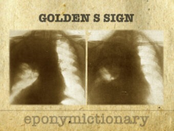 reverse S Archives • LITFL