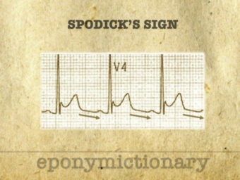 Spodick sign Archives • LITFL