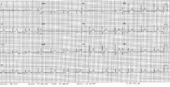 David Spodick • LITFL • Medical Eponym Library