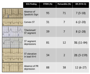 Spodick sign • LITFL • Medical Eponym Library