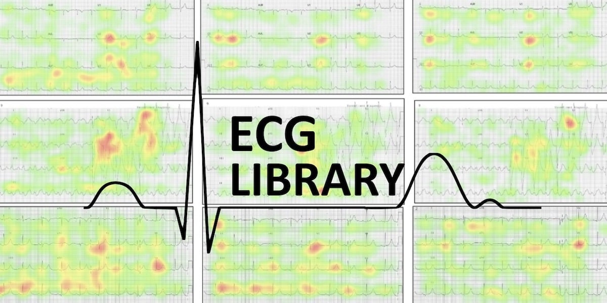 Developing Visual Expertise in ECG Interpretation • LITFL • ECG Library
