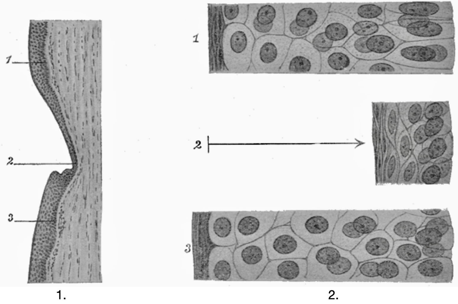Ernst Fuchs • LITFL • Medical Eponym Library
