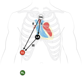 Thomas Lewis • LITFL • Medical Eponym Library