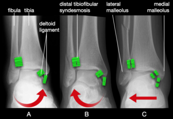 Robert Danis • LITFL • Medical Eponym Library