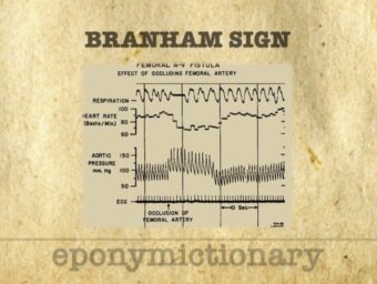 Nicoladoni-Israel-Branham sign Archives • LITFL
