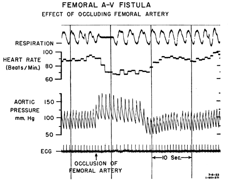 Branham sign • LITFL • Medical Eponym Library