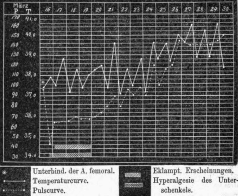 Branham sign • LITFL • Medical Eponym Library