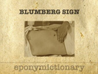 LITFL • Life in the Fast Lane