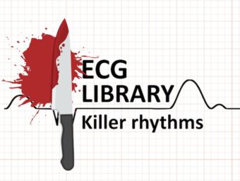 Brugada Syndrome Archives • LITFL