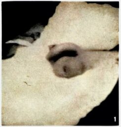 Ralph Ger • LITFL • Medical Eponym Library