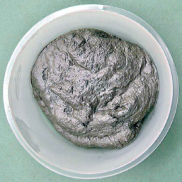 Thomas sign • LITFL • Medical Eponym Library