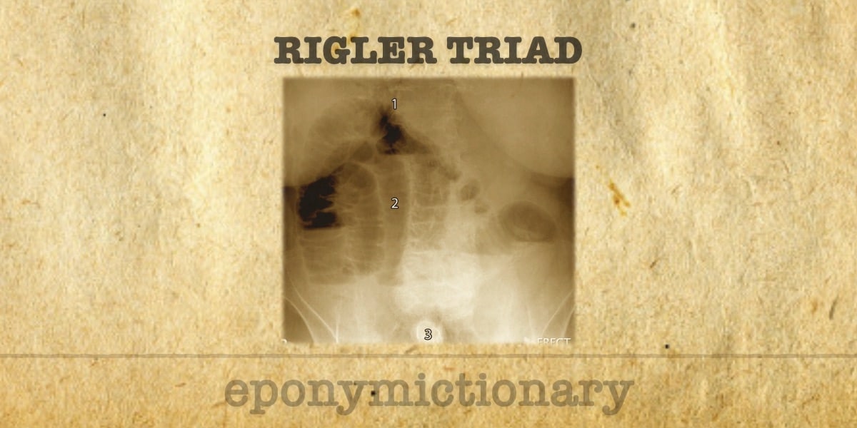 Rigler triad • LITFL • Medical Eponym Library