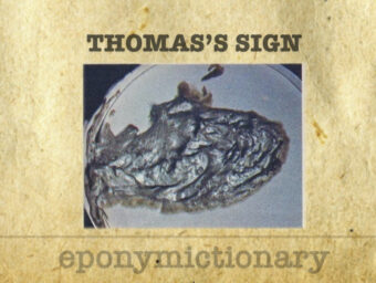 AM Thomas Archives • LITFL