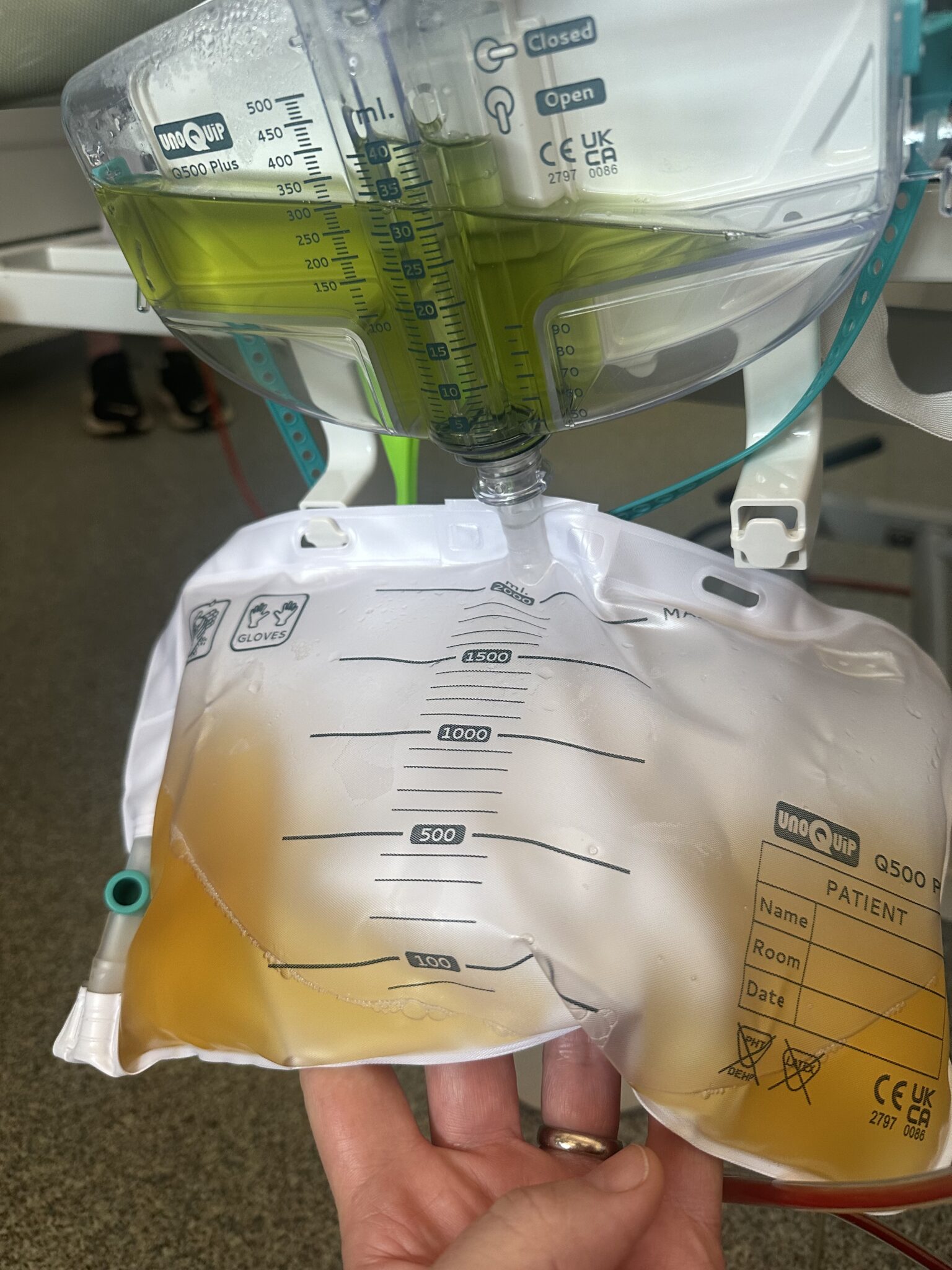 Green urine • LITFL • Unusual Urine