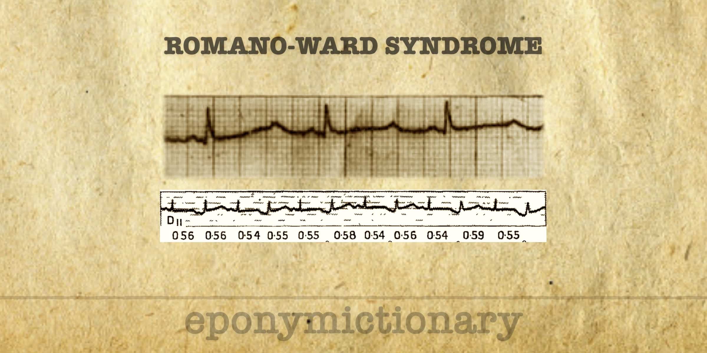 Romano-Ward syndrome • LITFL • Medical Eponym Library