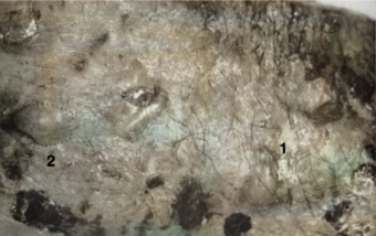 Gustav Asboe-Hansen • LITFL • Medical Eponym Library