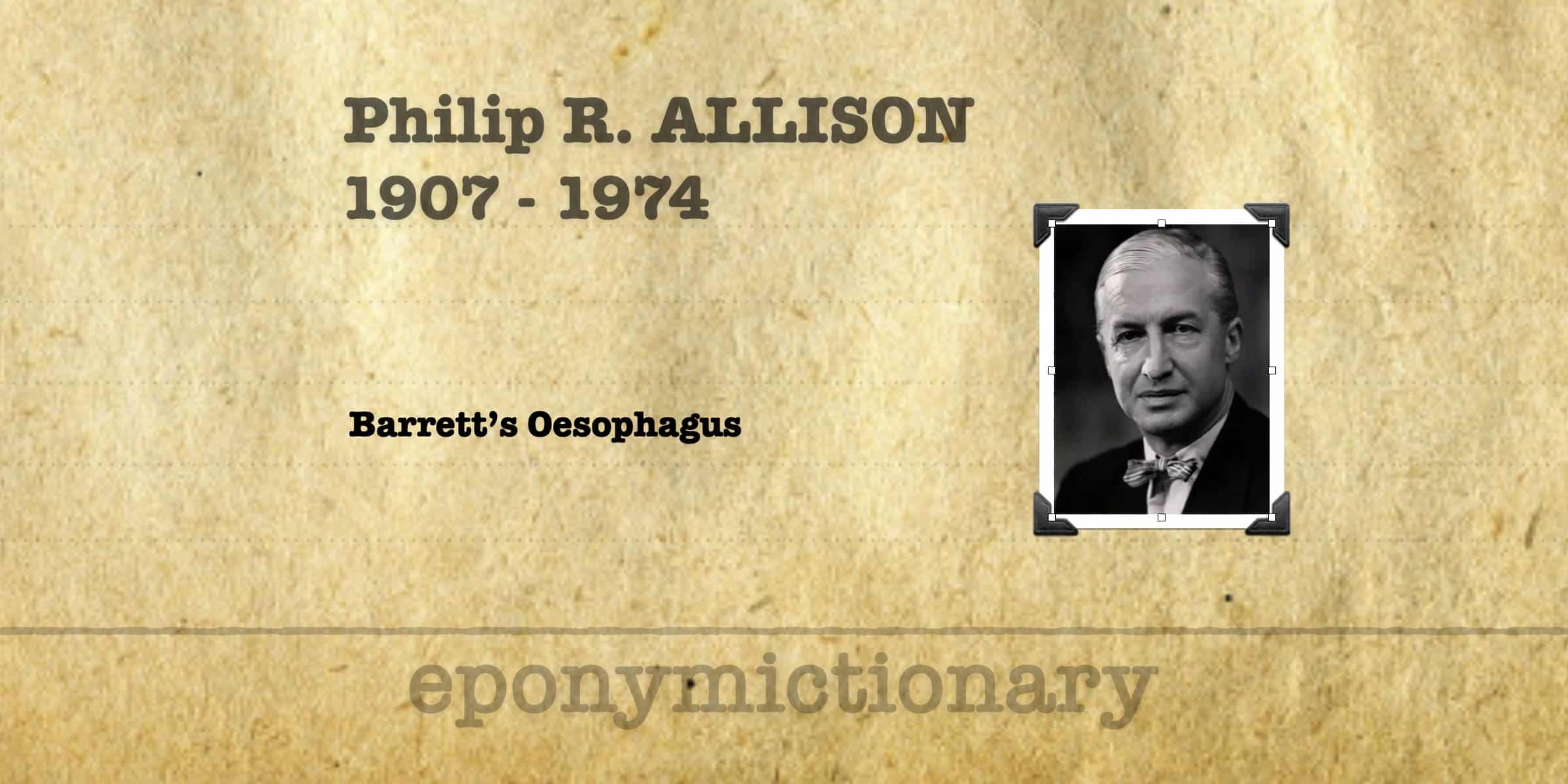 Philip Allison • LITFL • Medical Eponym Library