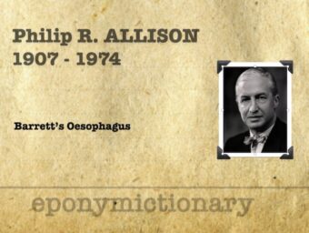 Philip Allison Archives • LITFL