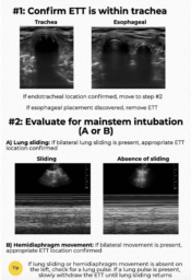 Airway Ultrasound • LITFL • CCC