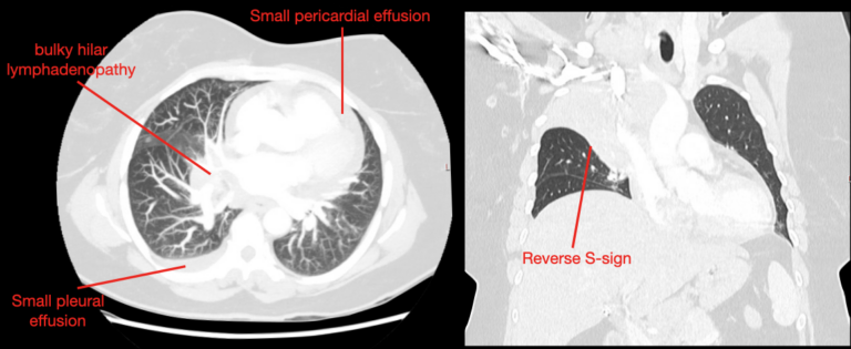 CT Case 007 • LITFL • CT scan interpretation
