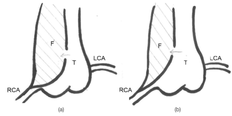CT Case 006 • LITFL • CT scan interpretation
