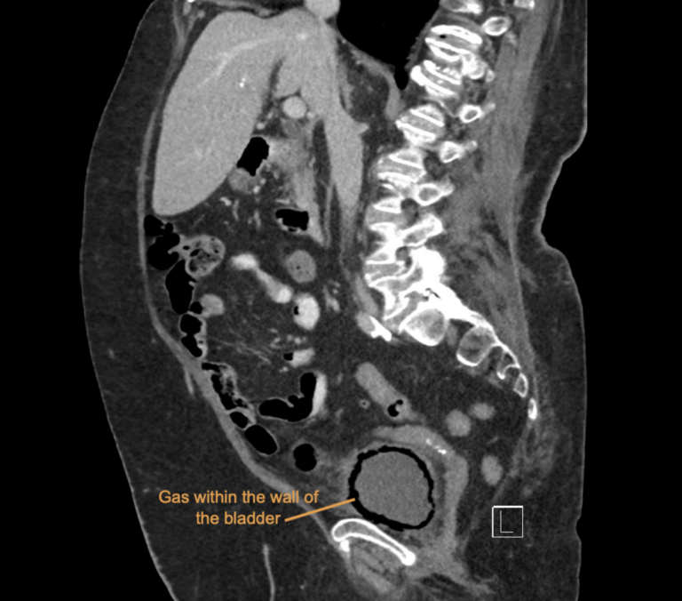 CT Case 015 • LITFL • CT scan interpretation