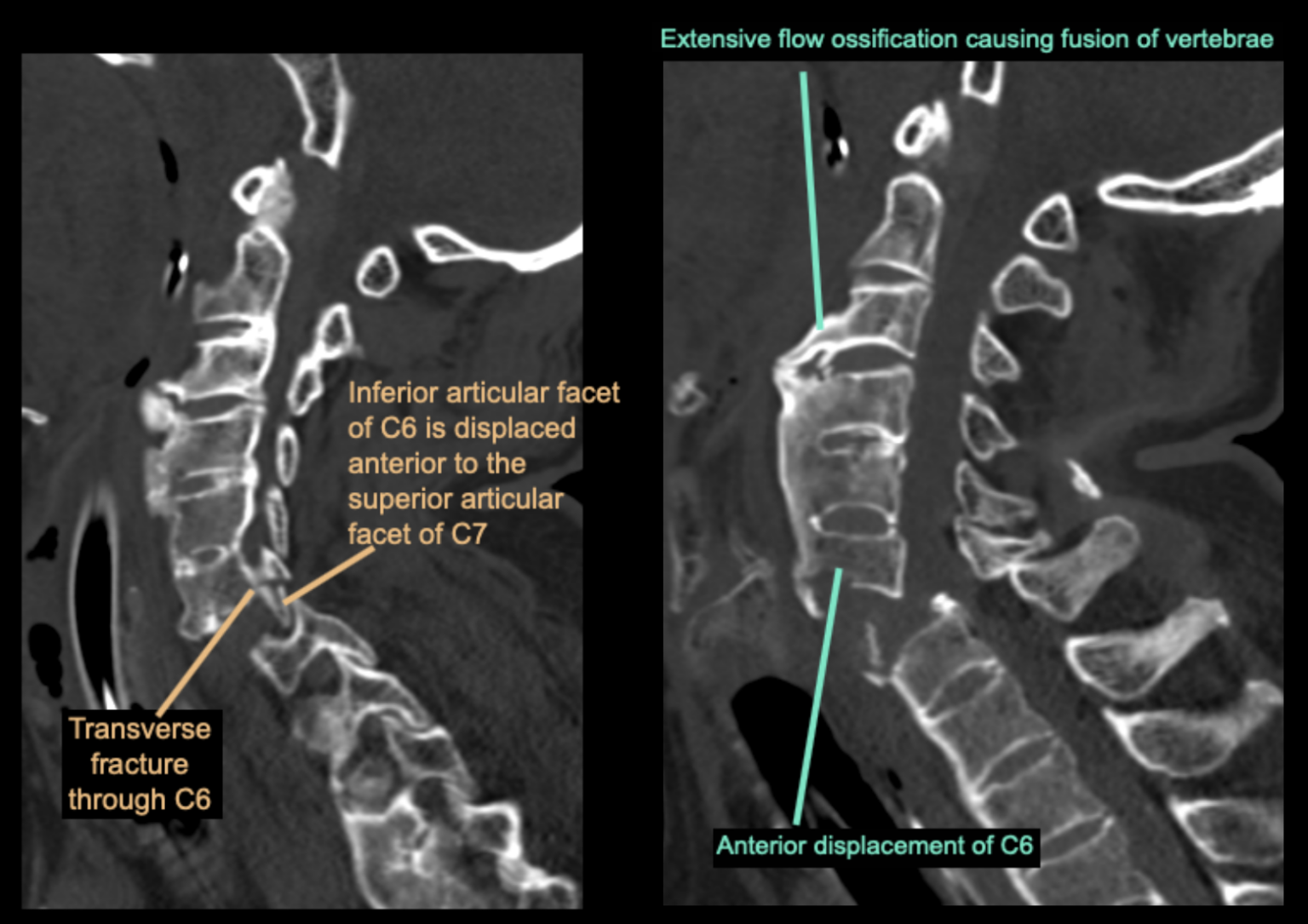 CT Case 017 • LITFL • CT scan interpretation