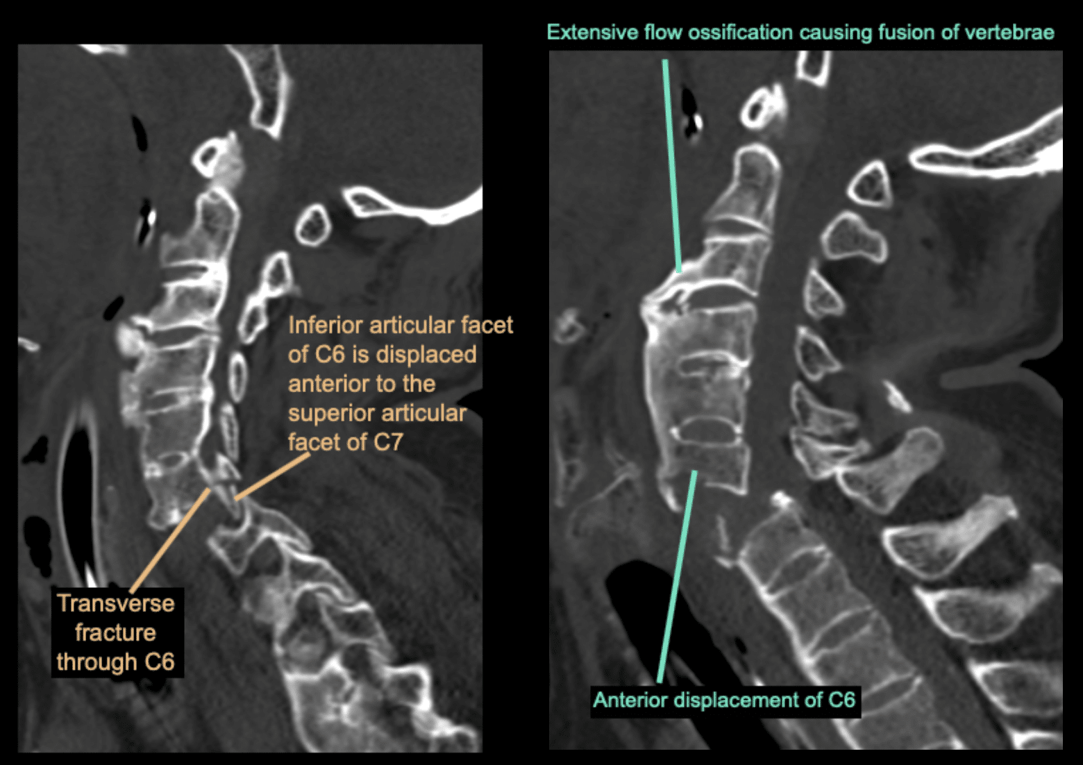 CT Case 017 • LITFL • CT scan interpretation
