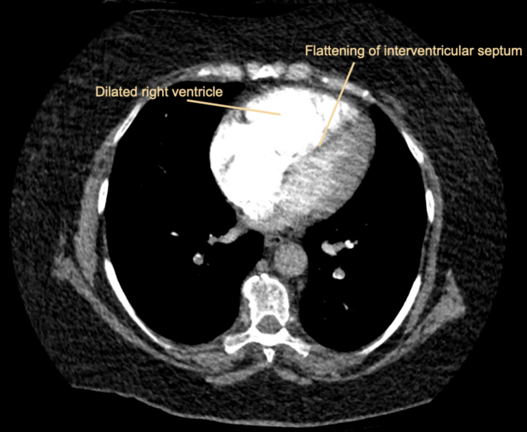 CT Case 009 • LITFL • CT scan interpretation