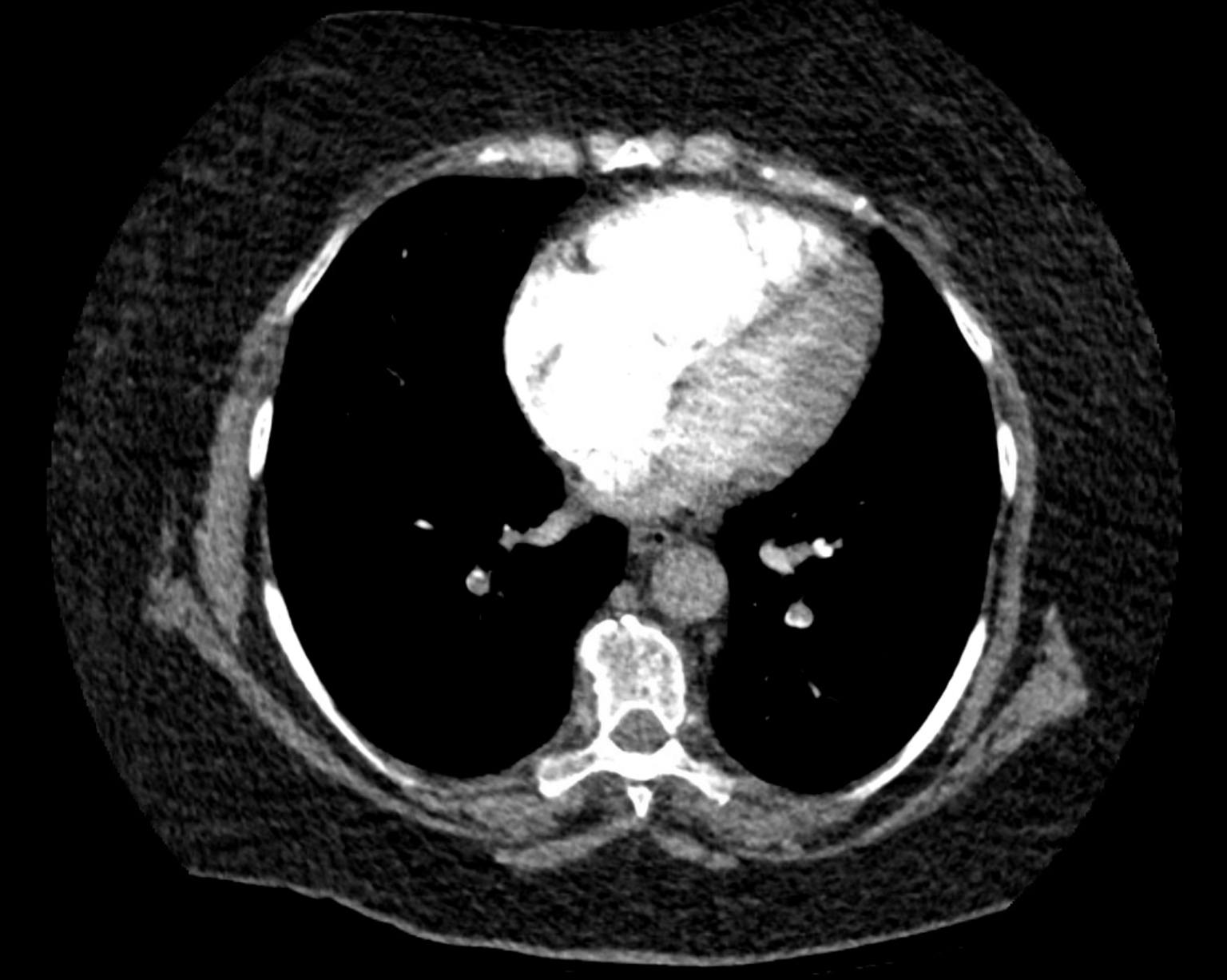 CT Case 009 • LITFL • CT scan interpretation