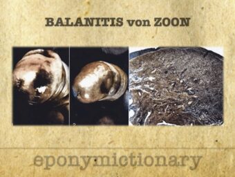 Johannes Zoon Archives • LITFL