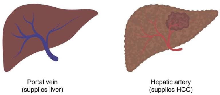 Abdominal CT: Cancer staging • LITFL • Radiology library