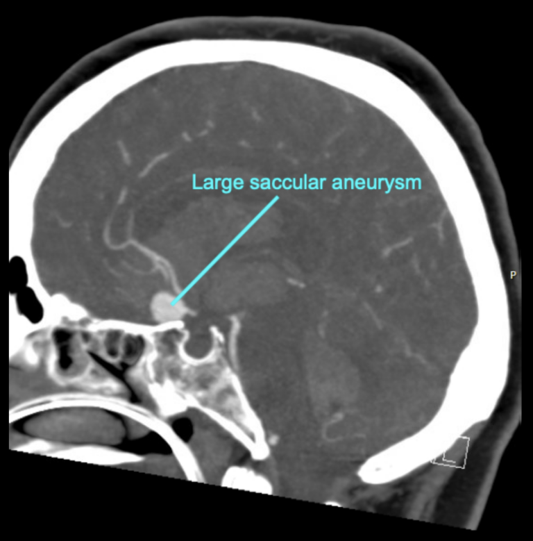CT Case 018 • LITFL • CT scan interpretation