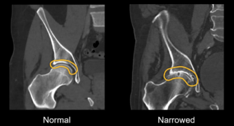 Abdominal CT: bones • LITFL • Radiology Library