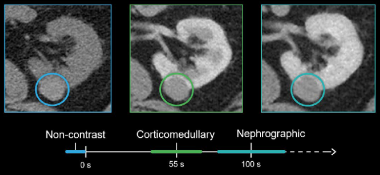 Abdominal CT: GU imaging • LITFL • Radiology library