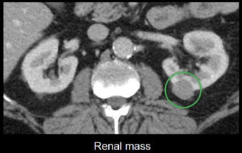 Abdominal CT: GU imaging • LITFL • Radiology library
