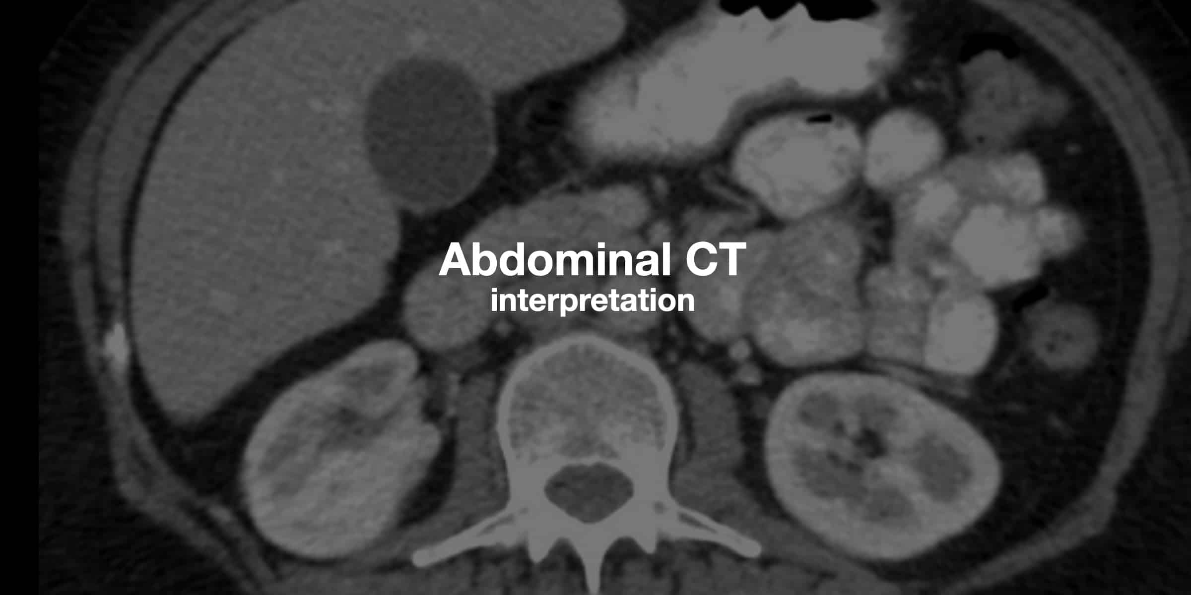 What Is The Role Of Abdominal CT LITFL Radiology Library