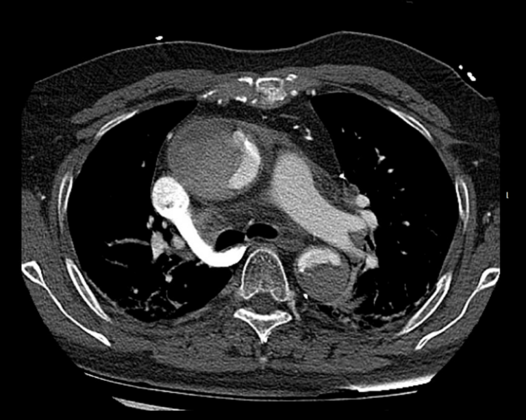 CT Case 006 • LITFL • CT scan interpretation