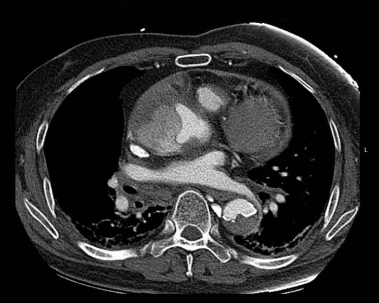 CT Case 006 • LITFL • CT scan interpretation