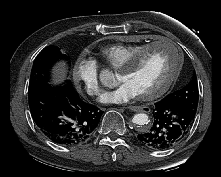 CT Case 006 • LITFL • CT scan interpretation