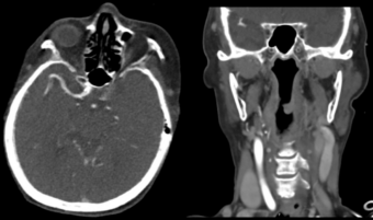 CT Case 005 • LITFL • CT scan interpretation