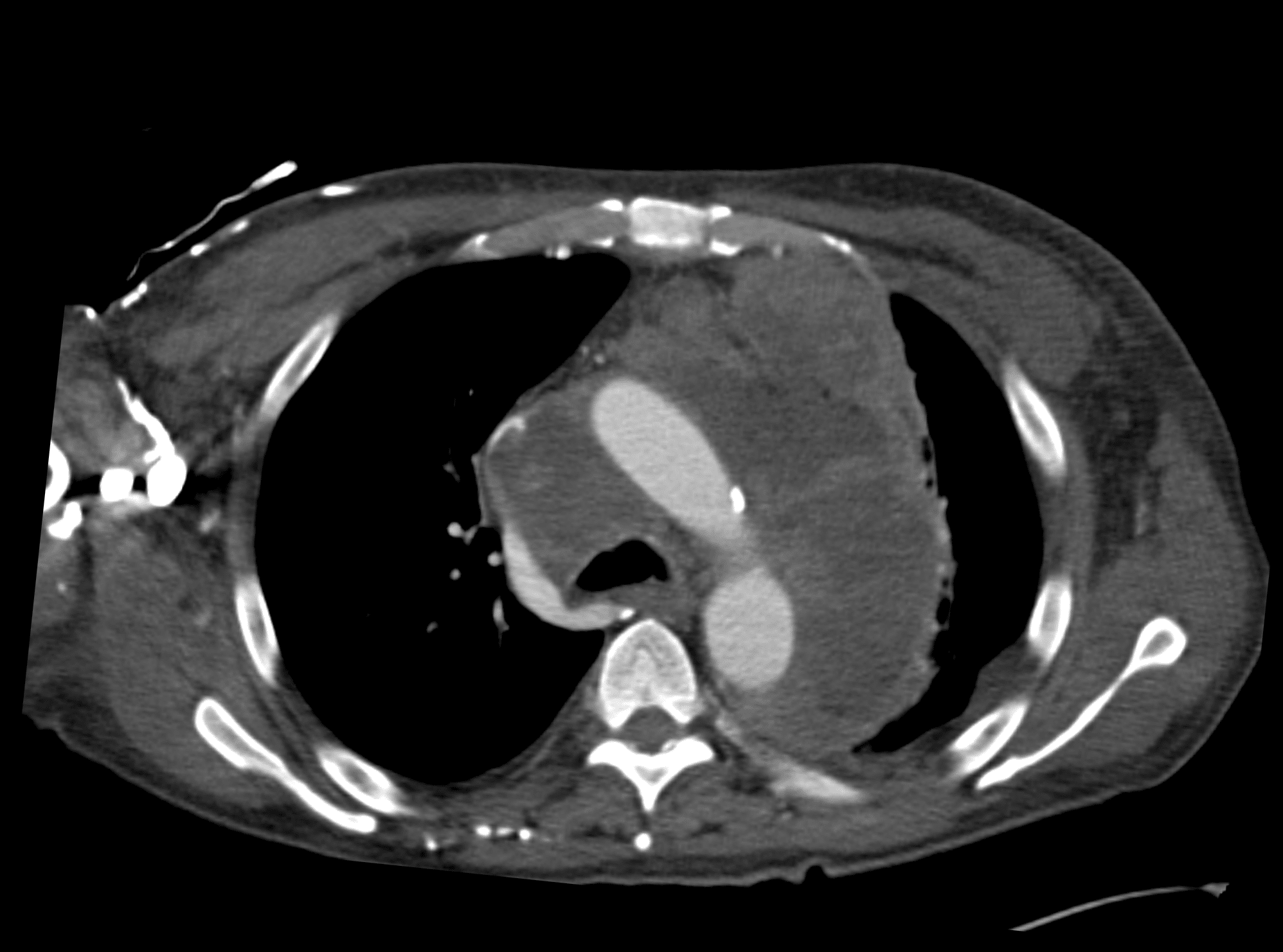 CT Case 038 • LITFL • CT scan interpretation