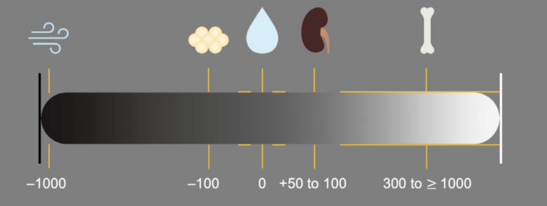 Abdominal CT: Windows advanced • LITFL • Radiology library