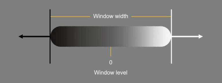 Abdominal CT: Windows advanced • LITFL • Radiology library
