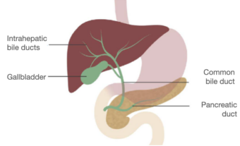 Abdominal CT: Biliary system and Pancreas • LITFL • Radiology