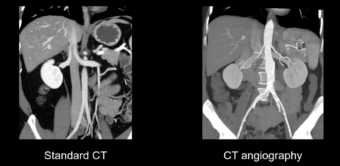 Abdominal CT: abdominal arteries • LITFL • Radiology Library