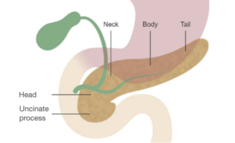 Abdominal CT: Biliary system and Pancreas • LITFL • Radiology