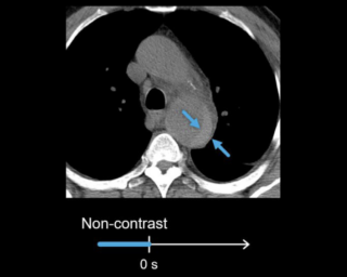 Abdominal CT: Phases • LITFL • Radiology library