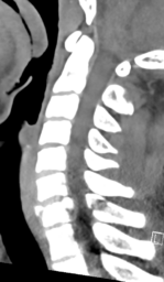CT Case 049 • LITFL • CT scan interpretation