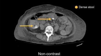 Abdominal CT: Phases • LITFL • Radiology library